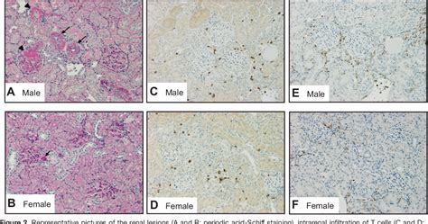 Figure 2 From Angiotensin 1 7 Receptor Antagonism Equalizes Angiotensin Ii Induced
