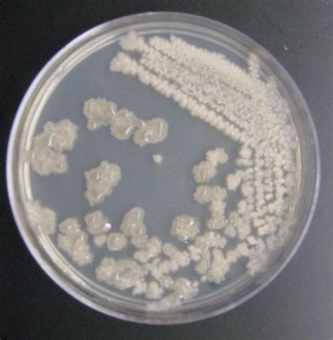 Bacillus Subtilis как удобрение фото