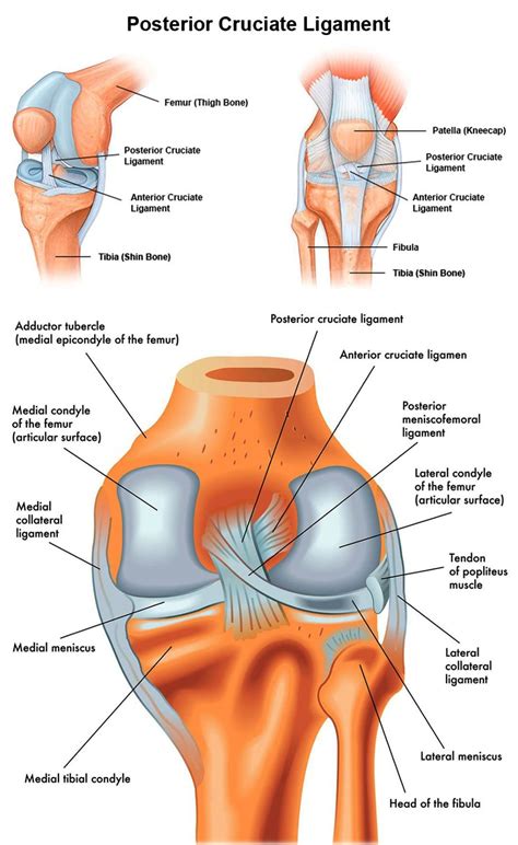 Posterior Cruciate Ligament Injuries Sciatica Clinic