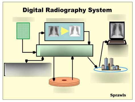 Diagram Of Digital Radiography Quizlet