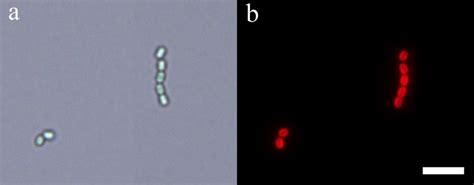 Strain Of Synechococcus Spp Isolated From Sanya Bay Scale Bar 10 μm