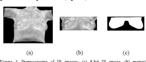 Figure 4 From Segmentation Of Infrared Breast Images Using Multiresunet Neural Networks