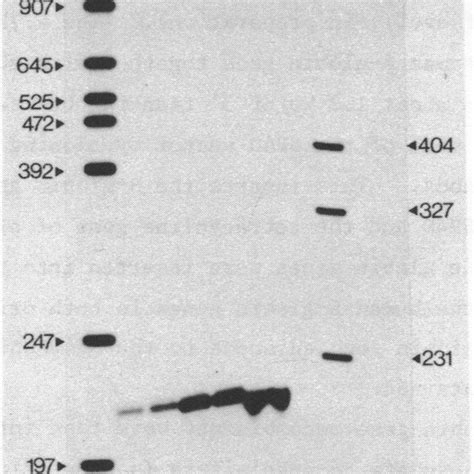 P Globin Mrna Levels Produced From Either The Thalassaemic Or Normal