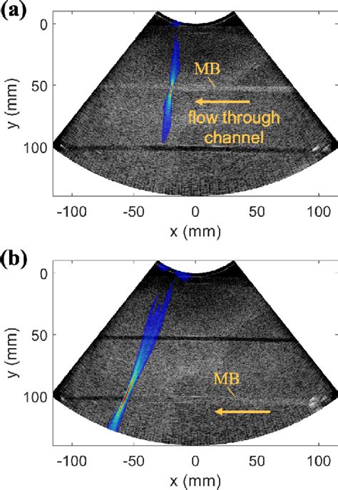 Figure 1 From A Fast Fourier Beamformer For Convex Array Passive Acoustic Mapping Semantic Scholar