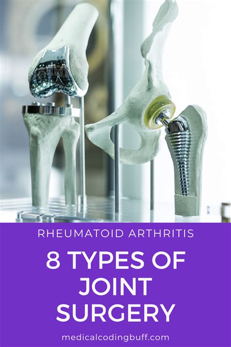 Joint Procedure Coding And Treatment Of Rheumatoid Arthritis Artofit