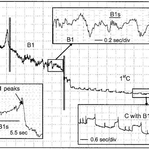 Complete Waveform Trace From Insect 26 With Inset Boxes Showing