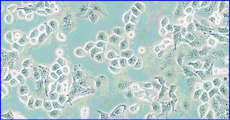 Cancer Cell Line Encyclopedia Ccle Available Free To Public As Resource Material