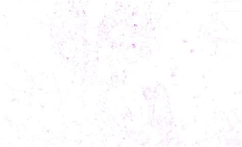 Creating Multiple Stain Vectors In Qupath With A Brightfield H Dab Image Image Analysis