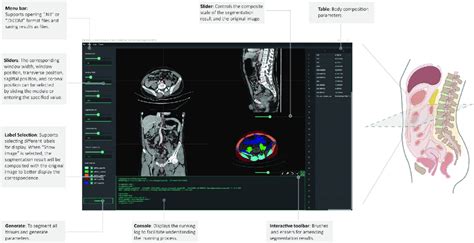 Pretreatment Ct Images Were Used To Measure Subcutaneous Fat Area Download Scientific Diagram
