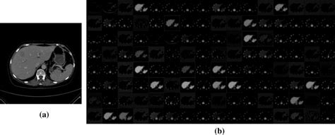 A Sample Organ Slice B Visualization Of Activation Maps Corresponding