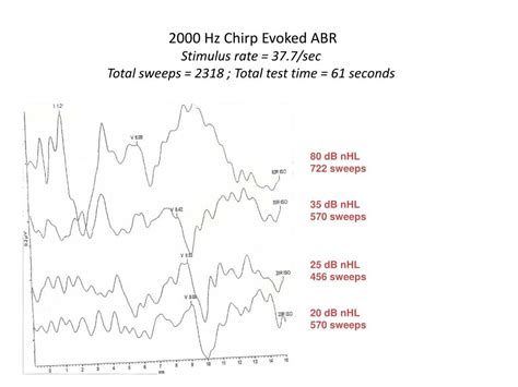 Ppt Limitation Of Click Evoked Abr Lack Of Frequency Specificity