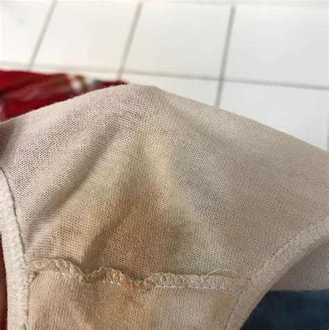 Tmi Panty Shotis This Normal Discharge Im 15 Weeks Its Brownish
