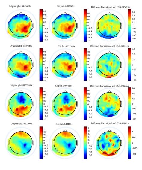 Comparison Of Clinic Based Eeg Data Versus Cs Algorithm Number Of