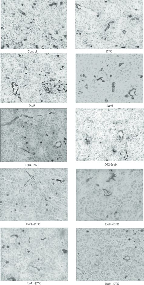 Immunohistochemical Detection Of Cd34 Expression In Tumor Xenografts
