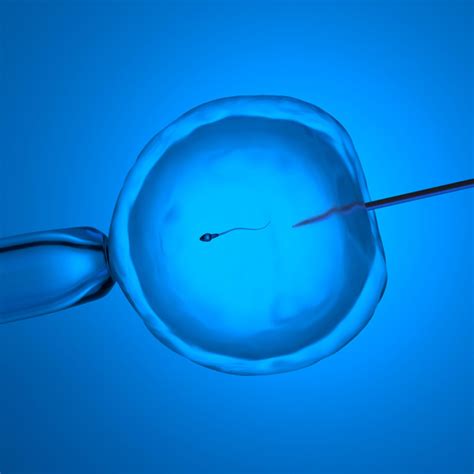 Role Of Intracytoplasmic Sperm Injection In Ivf Treatments In Patients