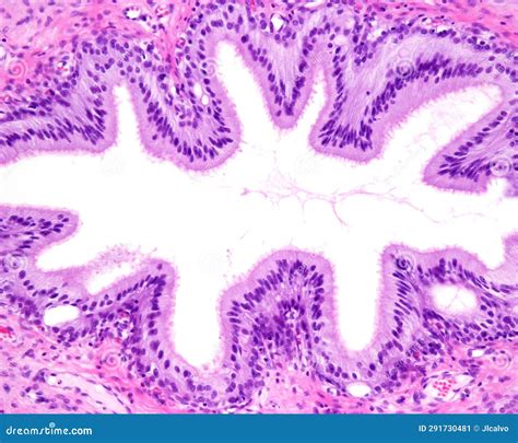 Vas Deferens Pseudostratified Epithelium Stock Image Image Of Hematoxylineosin Micrograph