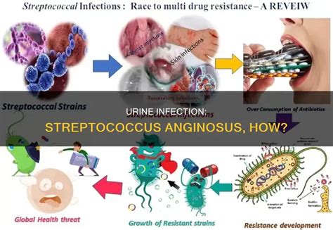 Urine Infection Streptococcus Anginosus How Medshun