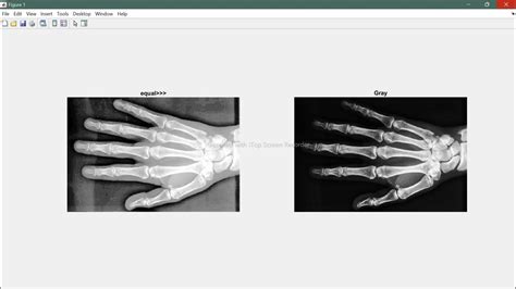 Basic Of Image Processing Using Matlab 1 Imread Imshow Rgb2gray