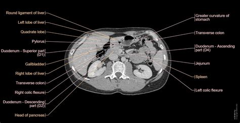 Abdomen And Pelvis Normal Anatomy E Anatomy 47 Off