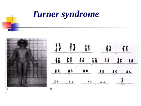 Topic Methods Of Human Genetics Cytogenetic Method And