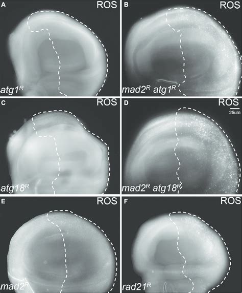 Blocking Autophagy Causes Redox Stress In Cin Cells Cellrox Staining Download Scientific