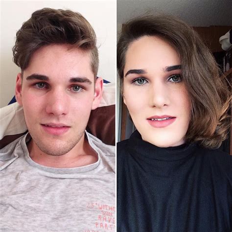 Over A Year And A Half Of Hair Growth And 6 Months On T Blockers