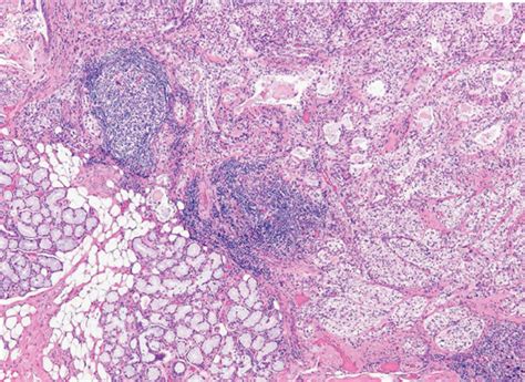 Microscopic And Survey View Of The Surgical Resected Specimen A Download Scientific Diagram