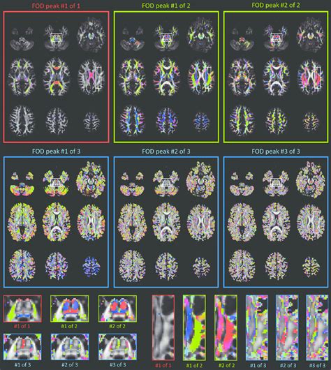 8 Direction Encoded Color Dec Maps Of Fi Ber Orientation Distribution Download Scientific