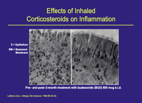 Asthma Controller Medications Flashcards Quizlet
