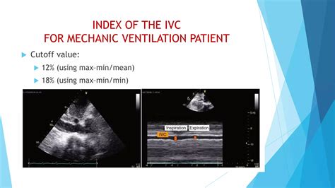 Echocardiography In Shock PPTX