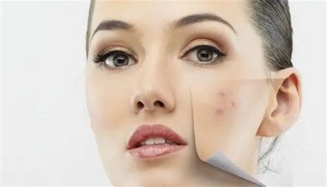 Cpg Adalah Obat Manfaat Dosis Dan Efek Samping Feeds