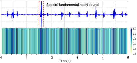 Heart Sound Signals And Corresponding Attention Maps Learned By The Cta Download Scientific