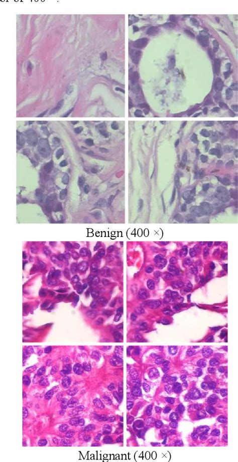 Figure 2 From Comparative Analysis Of Medical Images Using Transfer Learning Based Deep Learning