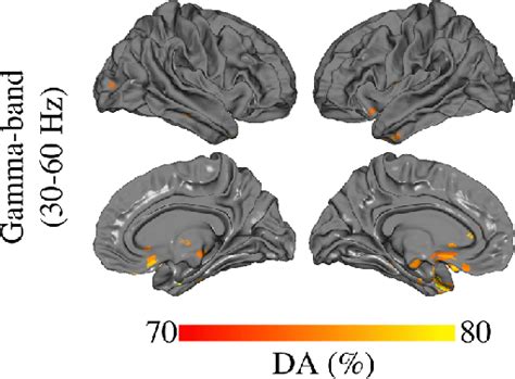 Significant Classification Of Schizophrenia Patients And Healthy Download Scientific Diagram