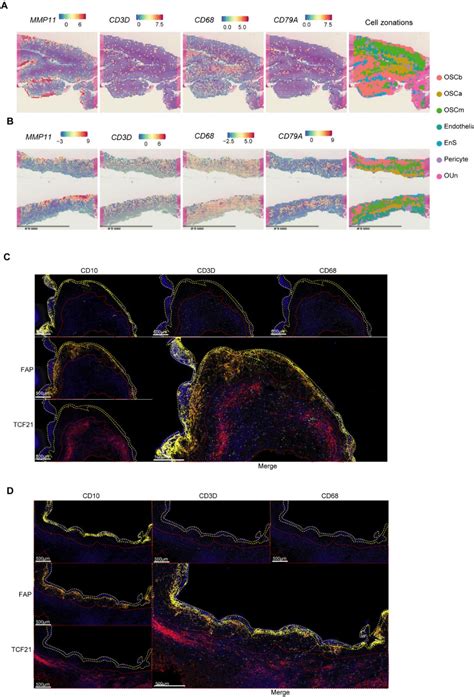 Figure 4 From Single Cell And Spatial Transcriptomic Profiling Revealed Niche Interactions