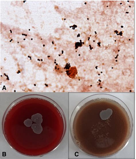 Photomicrograph Of Smear A Shows Gram Positive Cocci In Clumps And Download Scientific