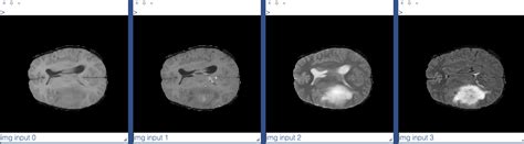 testing problems · issue 5 · juliawolleb diffusion anomaly · github