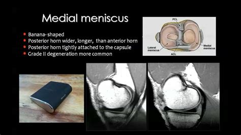 Pin On Bone And Joints