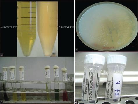 Molecular Identification Of An Enterococcus Faecalis Endocarditis Antigen Efaa In Root Canals Of