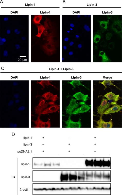 Lipin 1 And Lipin 3 Influence The Subcellular Localization And Levels