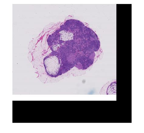 Blockedimagedatastore Datastore For Use With Blocks From Blockedimage