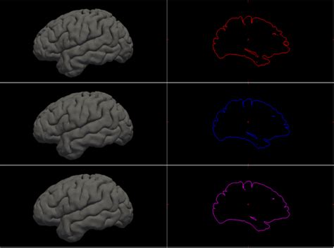Exvivo Surface Mesh Reconstruction From In Vivo Freesurfer Meshes Sgi 2023