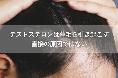 「男性ホルモンが多い人＝ハゲる」って嘘？本当？テストステロンと薄毛の関係とは個人輸入代行・通販ラククル