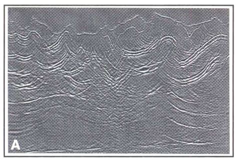 In The Foothills Prestack Depth Migration Is Interpretive Processing Canadian Society Of