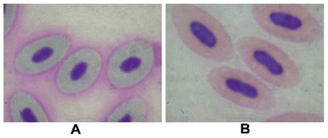 3 3 Microphotographs Of Erythrocytes Of Diploid A And Triploid B Download High