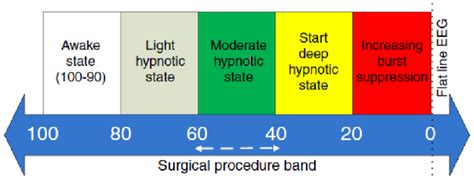 Bis Index Range And Patients State Download Scientific Diagram