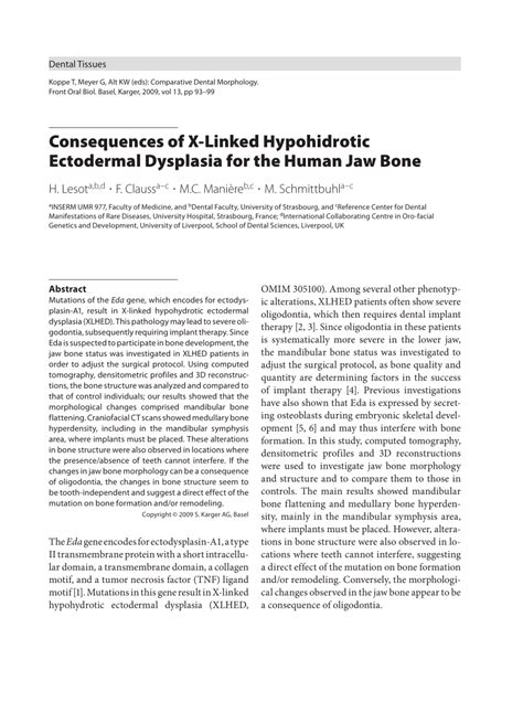 Pdf Consequences Of X Linked Hypohidrotic Ectodermal Dysplasia For The Human Jaw Bone