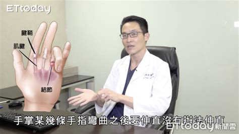 影滑手機害板機指 醫師一招神解讓指頭不在僵硬 ETtoday健康雲 ETtoday新聞雲
