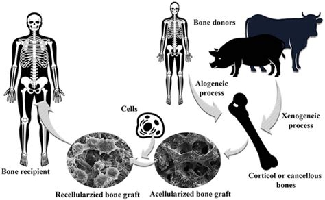 Criteria Challenges And Opportunities For Acellularized Allogeneic