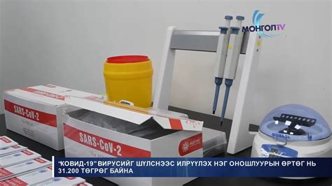 Шүлснээс Ковид 19 илрүүлэх оношлуур Монгол эрдэмтдийн бүтээсэн шүлснээс Корона вирусийг